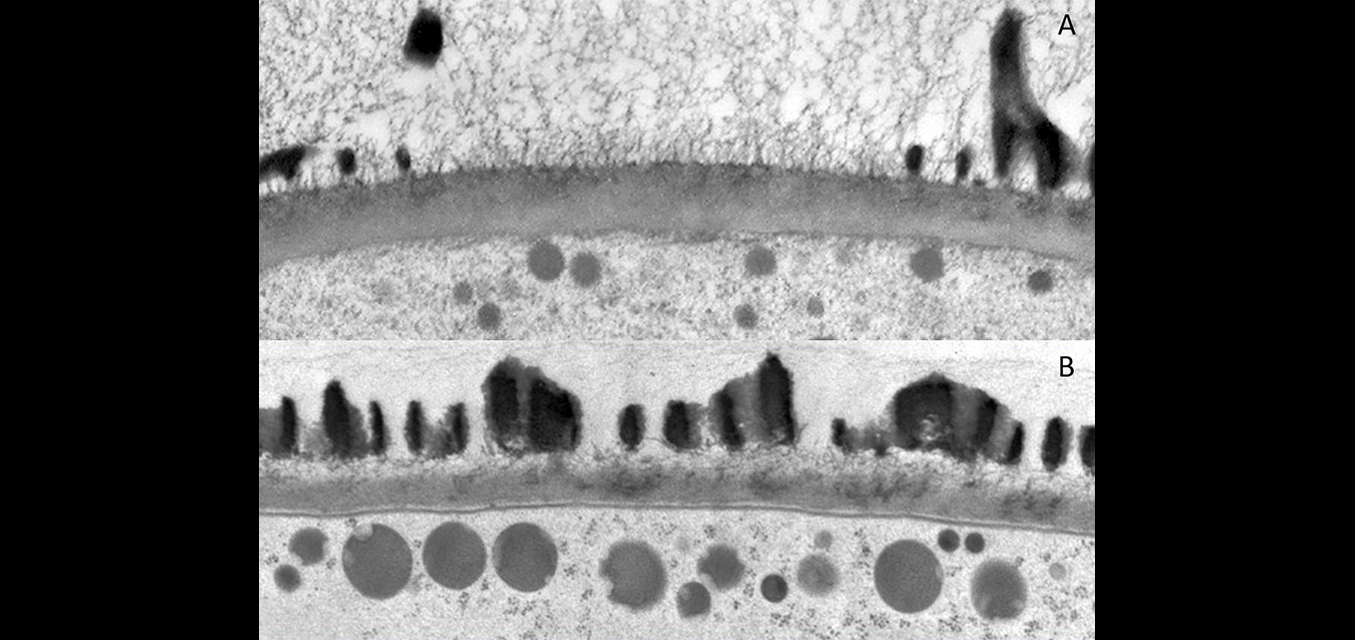 TEM Microscopy (General)