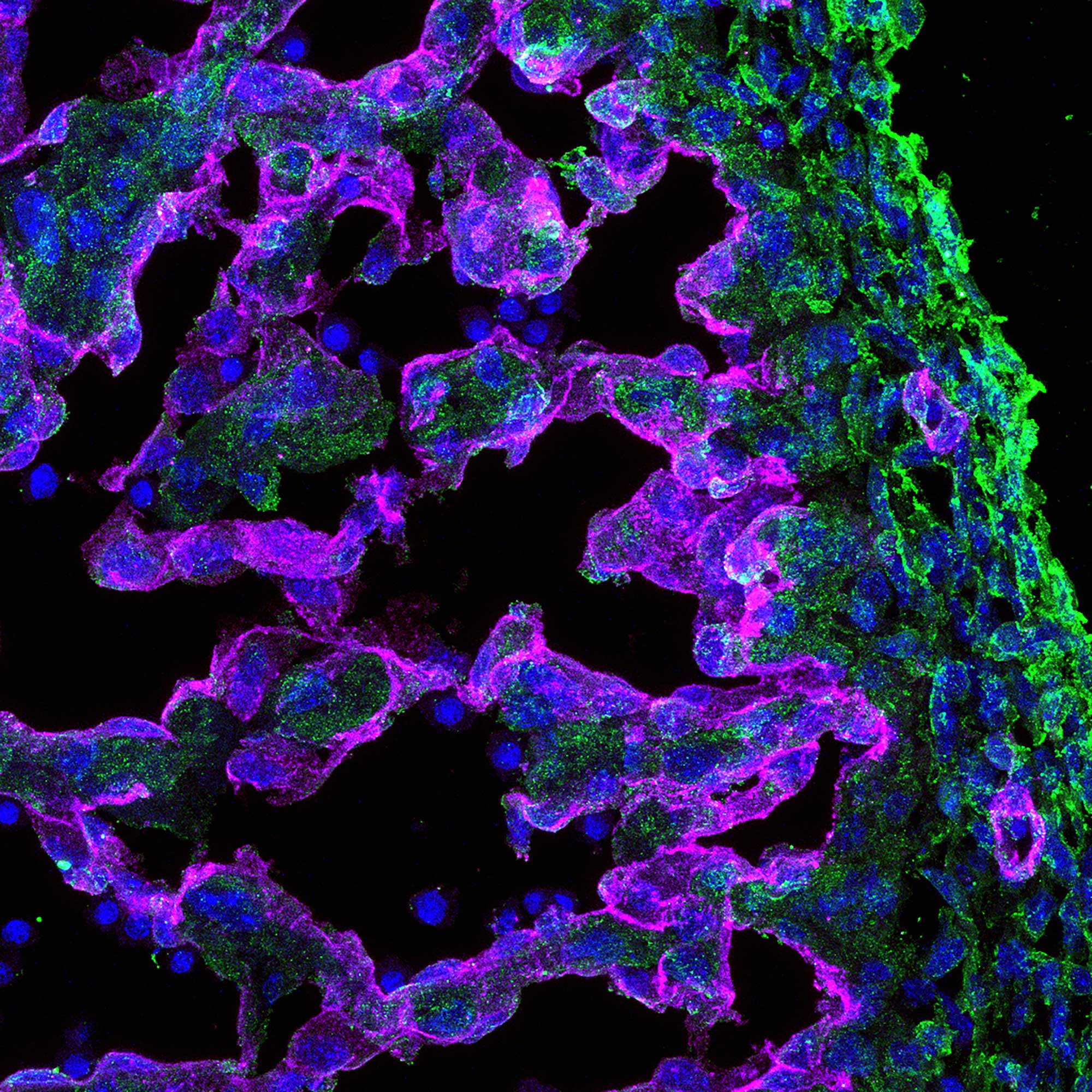 Reunion Art Exhibition